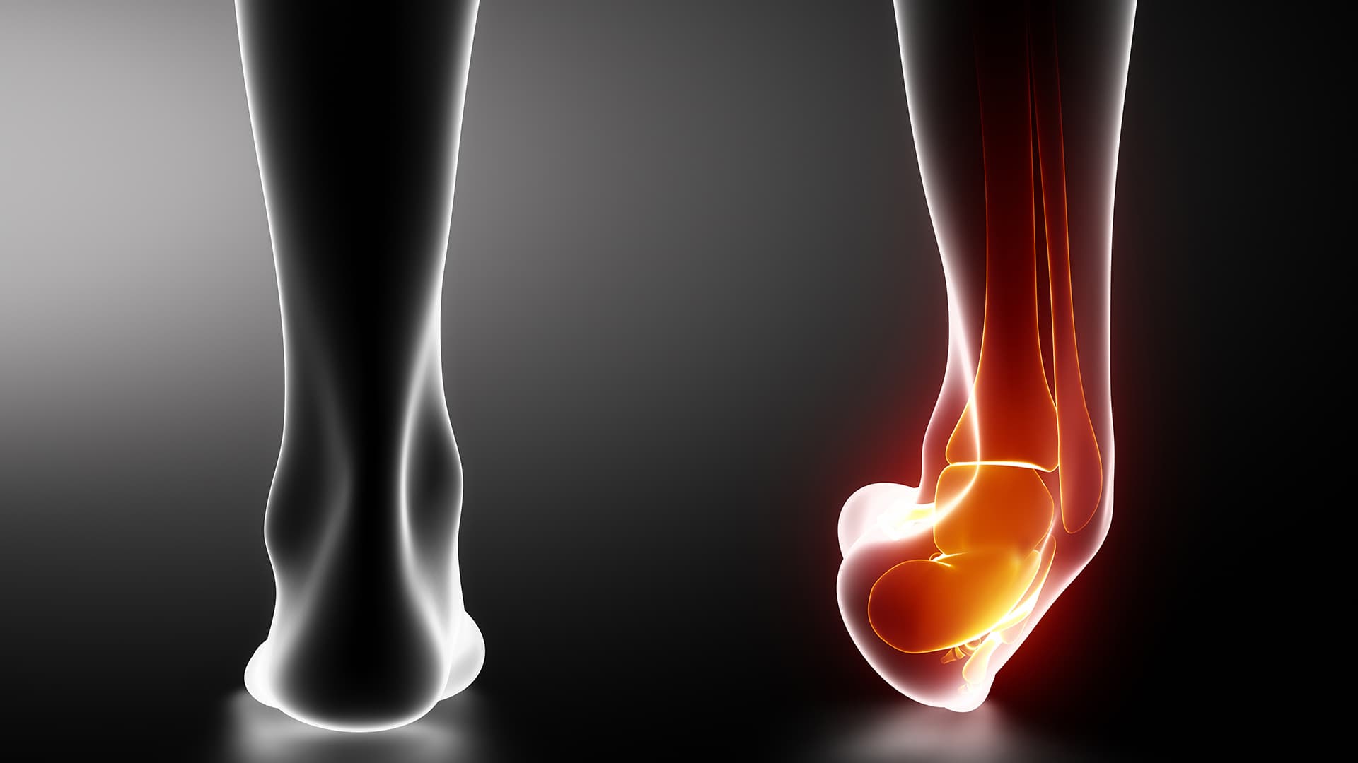 Formation Kinésithérapie de l’entorse de cheville : l’essentiel de l ...